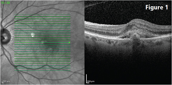 Ophthalmic Professional | PentaVision
