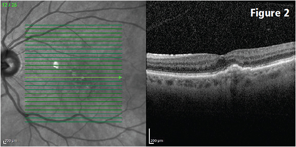 Ophthalmic Professional | PentaVision